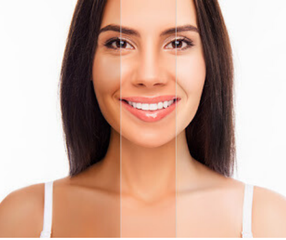 DIY MASK FOR SUN TAN AND DULL SKIN - V Beautify