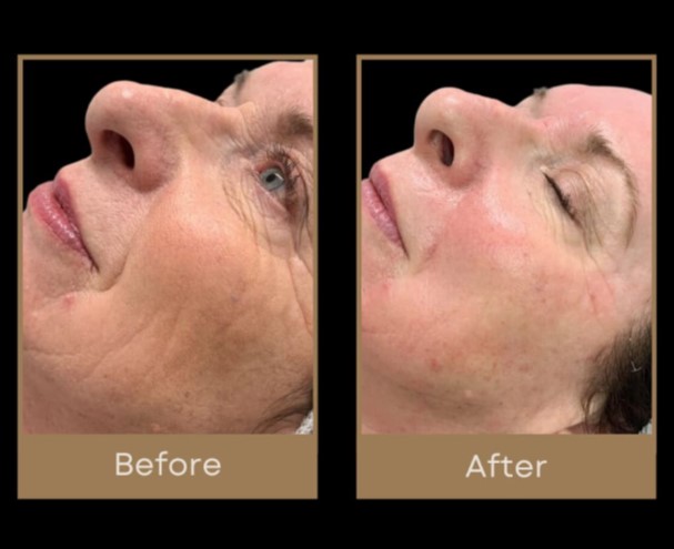 Ageless Skin Secrets: Natural Remedies for Youthful Appearance - V Beautify