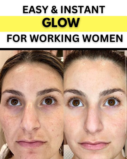 Easy and Instant Glow for Working Women: Home Remedies - V Beautify