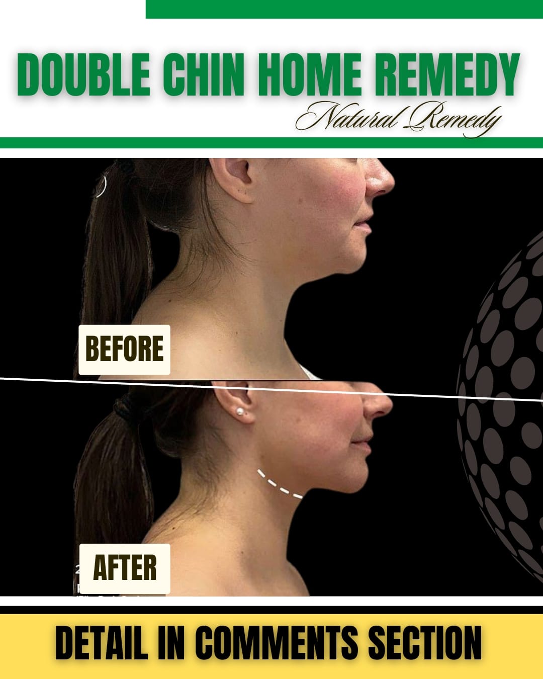Effective Home Remedies for Reducing Double Chin - V Beautify