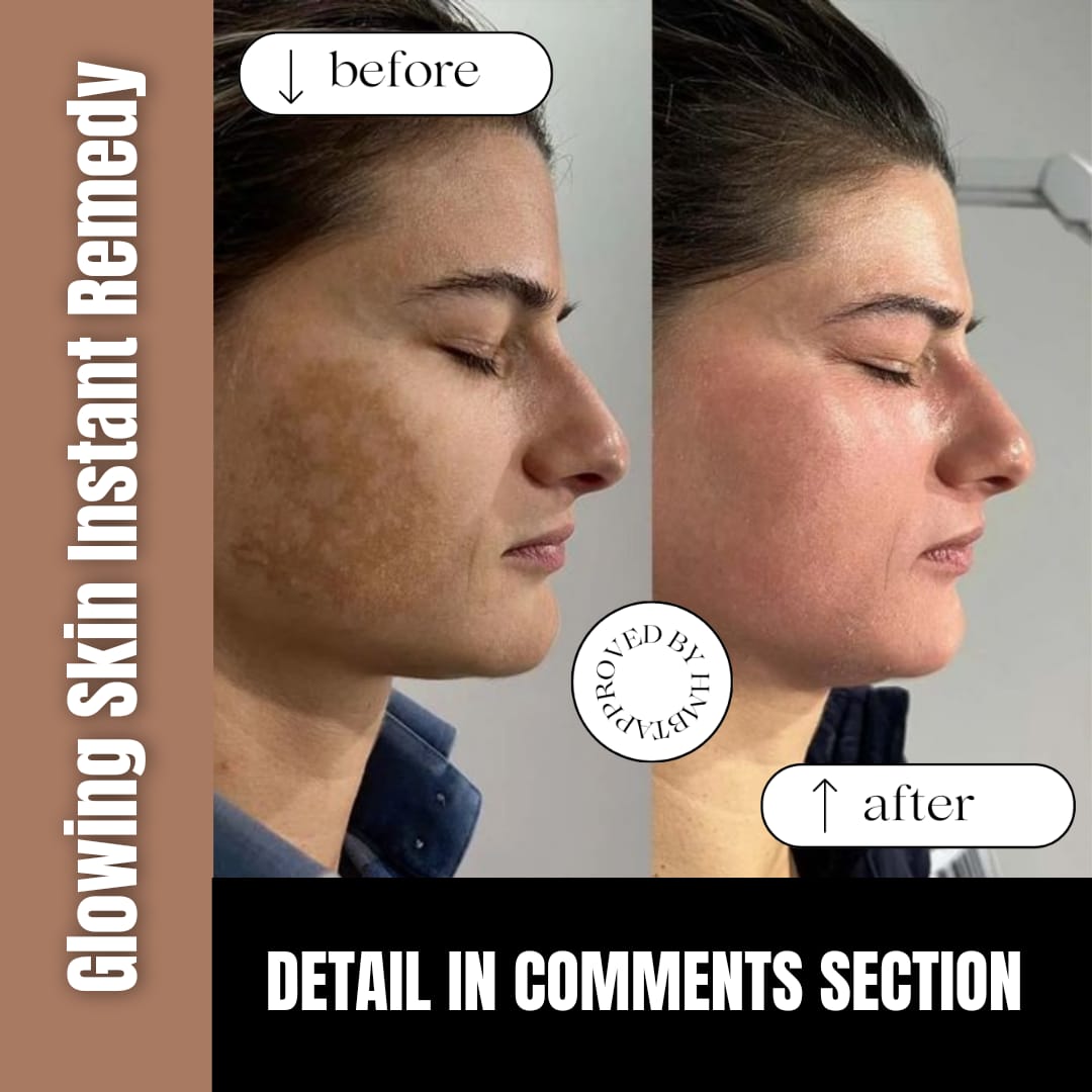 Glowing Skin Instant Remedy Home Remedies For Every Skin Type V Beautify