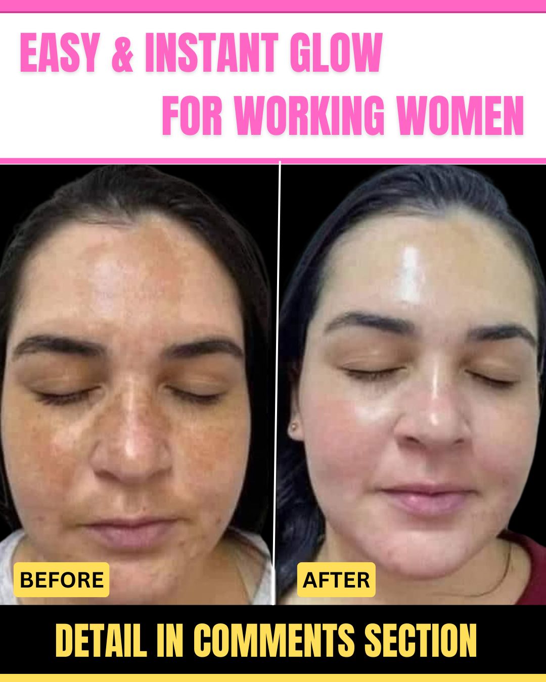 Instant Glow for Working Women: Effective Home Remedies for All Skin ...