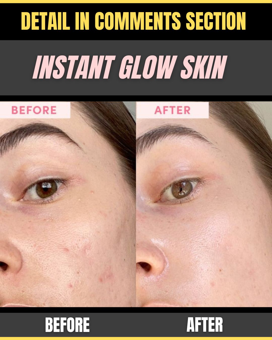 Achieve Instant Glow with These Effective Home Remedies for Every Skin ...