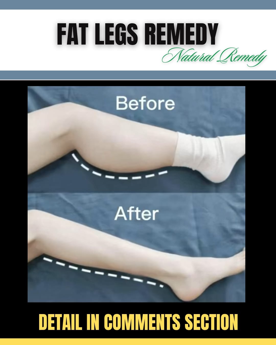 Ancient Remedies for Fat Legs: A 1000-Year Tradition of Toning and ...