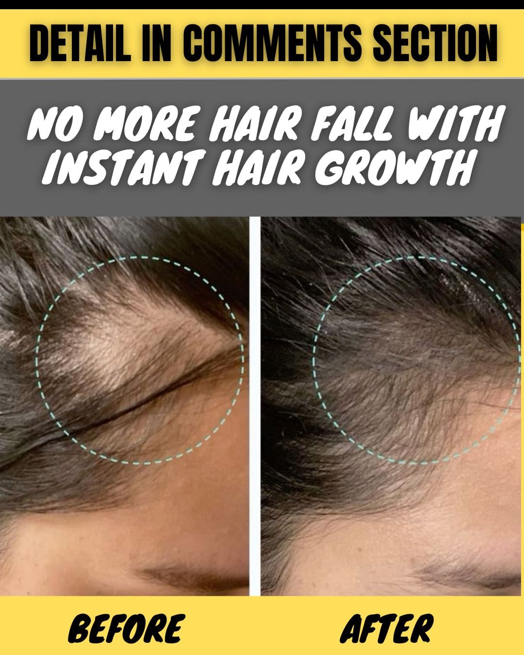 No More Hair Fall with Instant Hair Growth: Effective Home Remedies for ...