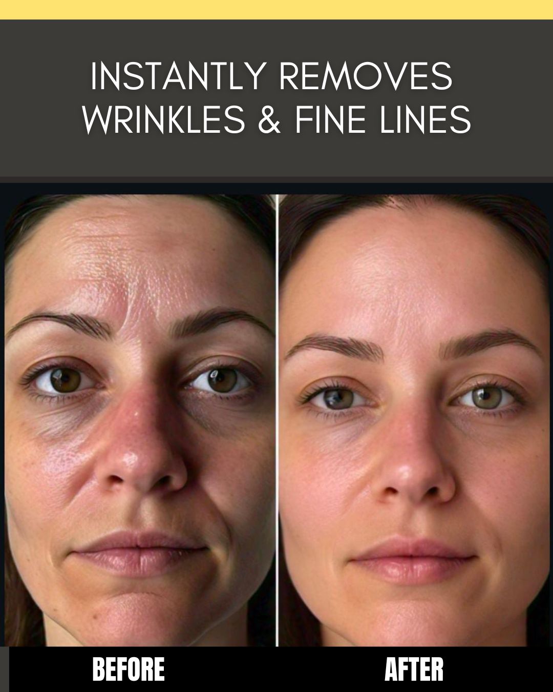 Instantly Remove Wrinkles and Fine Lines: Home Remedies for Smooth ...