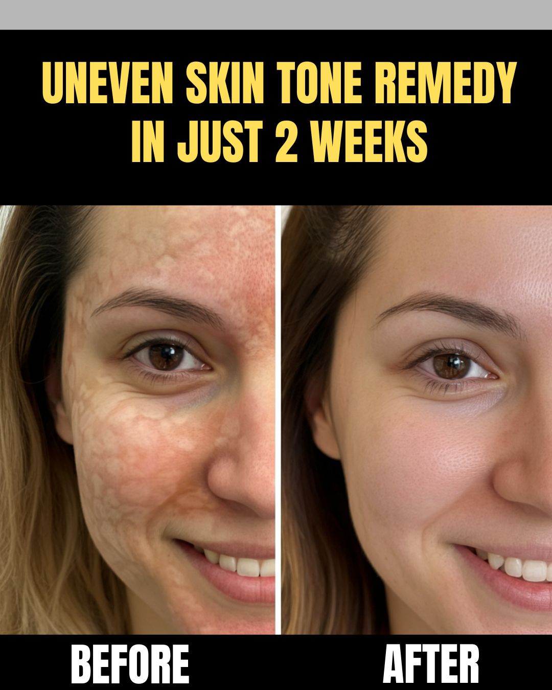 Uneven Skin Tone Remedy in Just 2 Weeks: Natural Solutions for All Skin ...