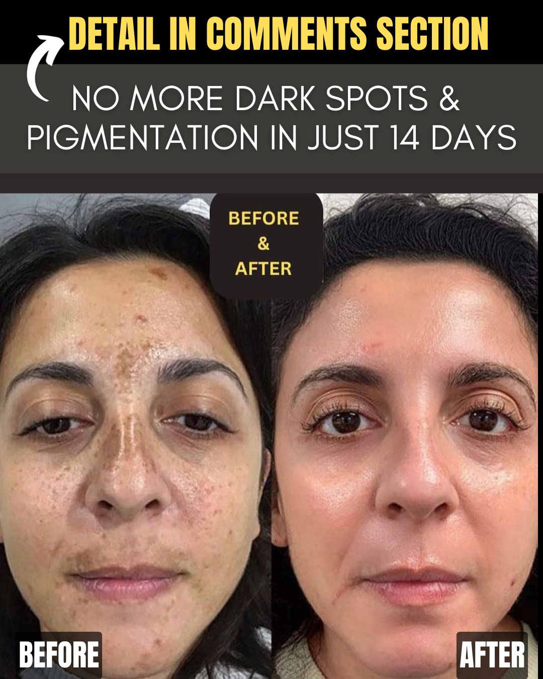 No More Dark Spots and Pigmentation in Just 14 Days: Natural Remedies ...