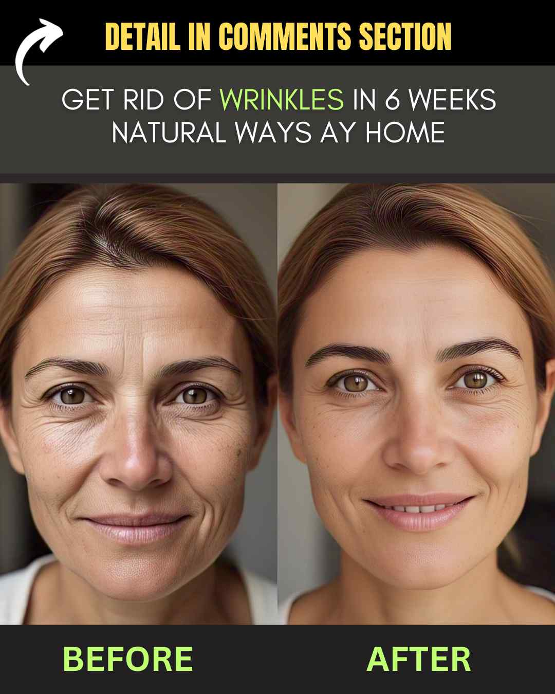 Instant Home Remedies to Get Rid of Wrinkles in 6 Weeks: Natural Ways ...