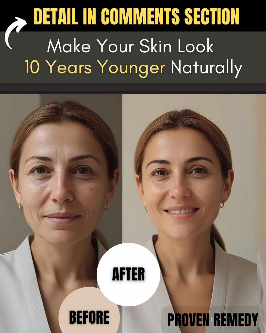 Make Your Skin Look 10 Years Younger Naturally - V Beautify