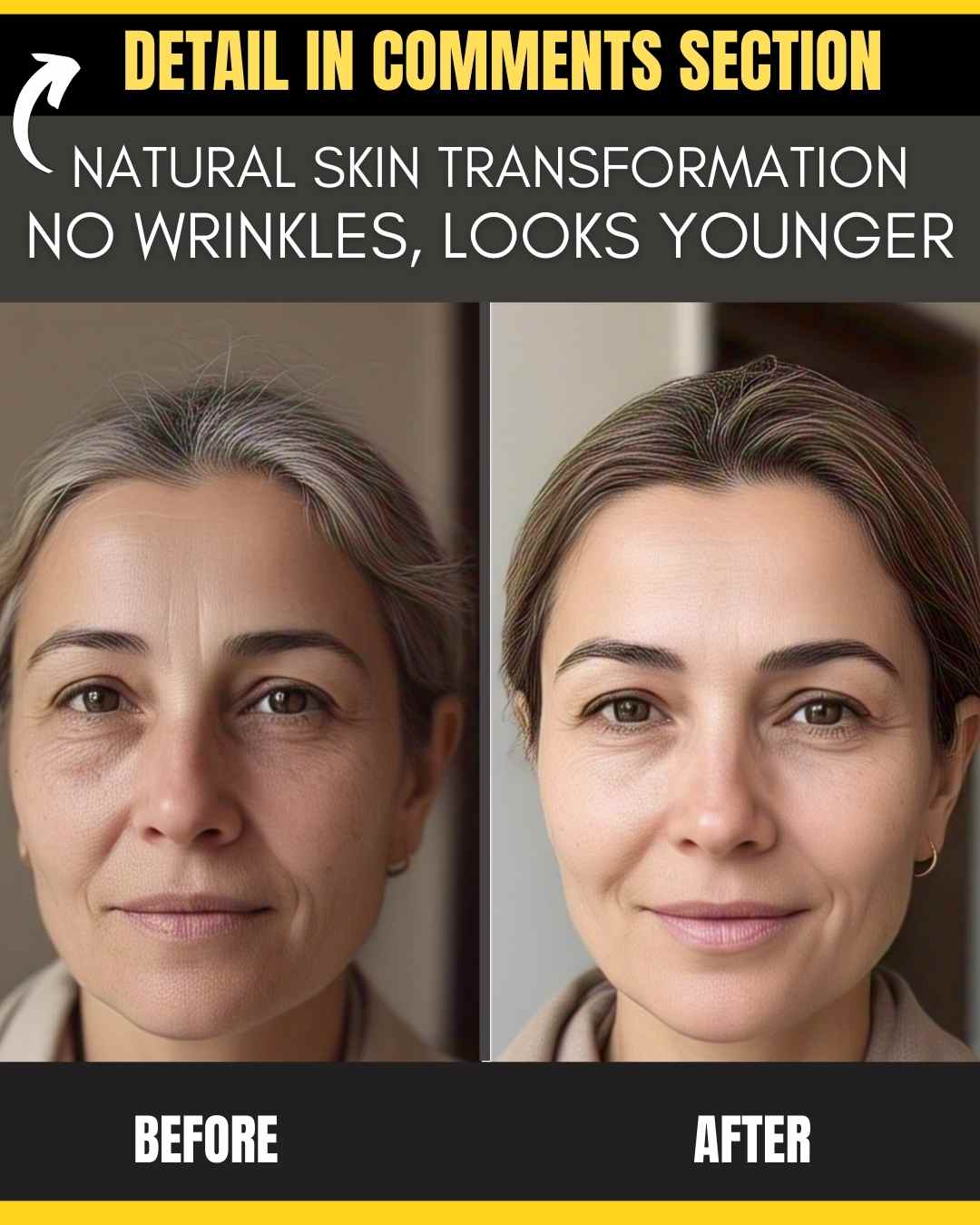 NATURAL SKIN TRANSFORMATION: NO WRINKLES, LOOKS YOUNGER - V Beautify