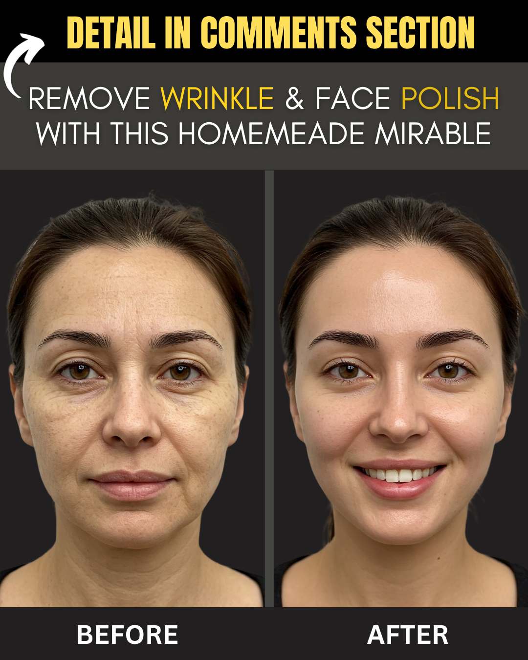 Instant Home Remedies to Remove Wrinkles & Polish Your Face: A Homemade ...
