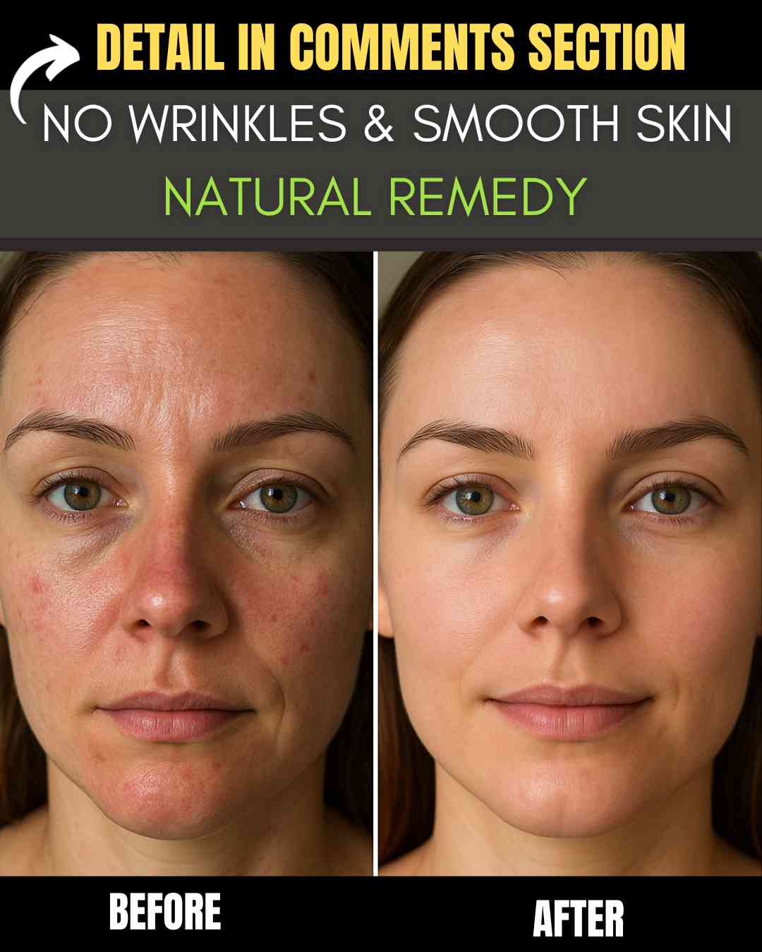 No Wrinkles & Smooth Skin: Natural Home Remedies by Skin Type - V Beautify