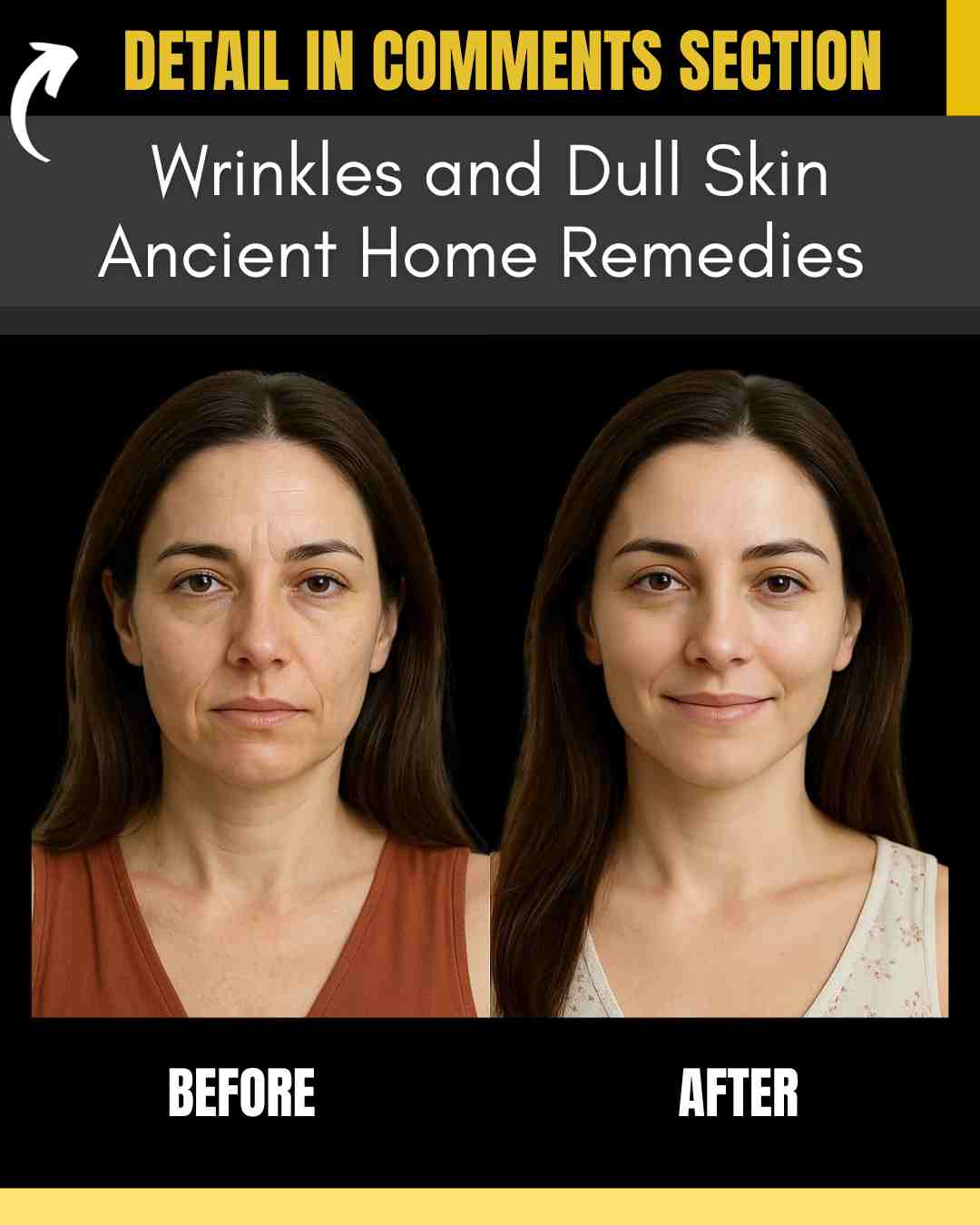Ancient Home Remedies for Wrinkles and Dull Skin by Skin Type - V Beautify