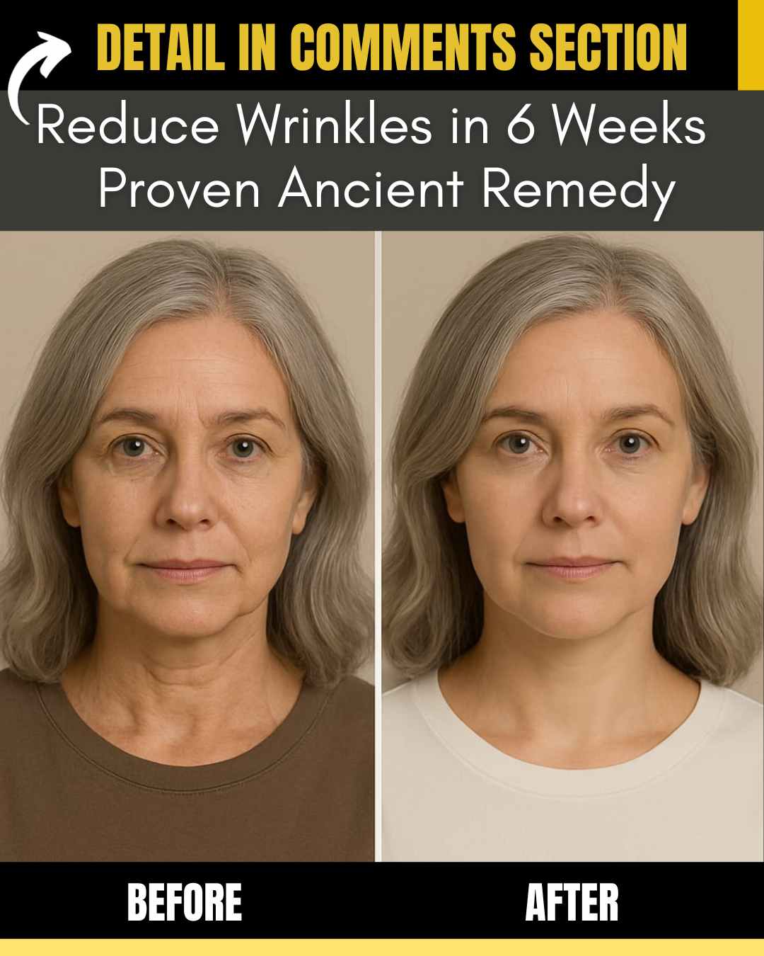 Instant Home Remedies to Reduce Wrinkles in 6 Weeks with This Proven ...