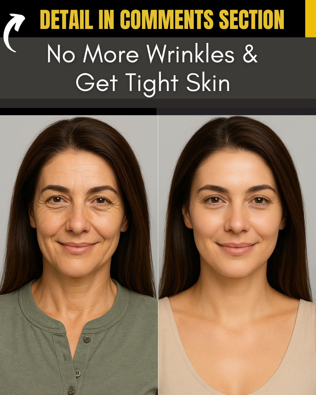 No More Wrinkles & Get Tight Skin - V Beautify