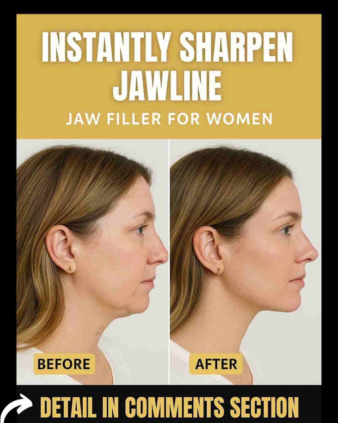 Home Remedies for Instantly Reducing and Sharpening Jawline for Women ...