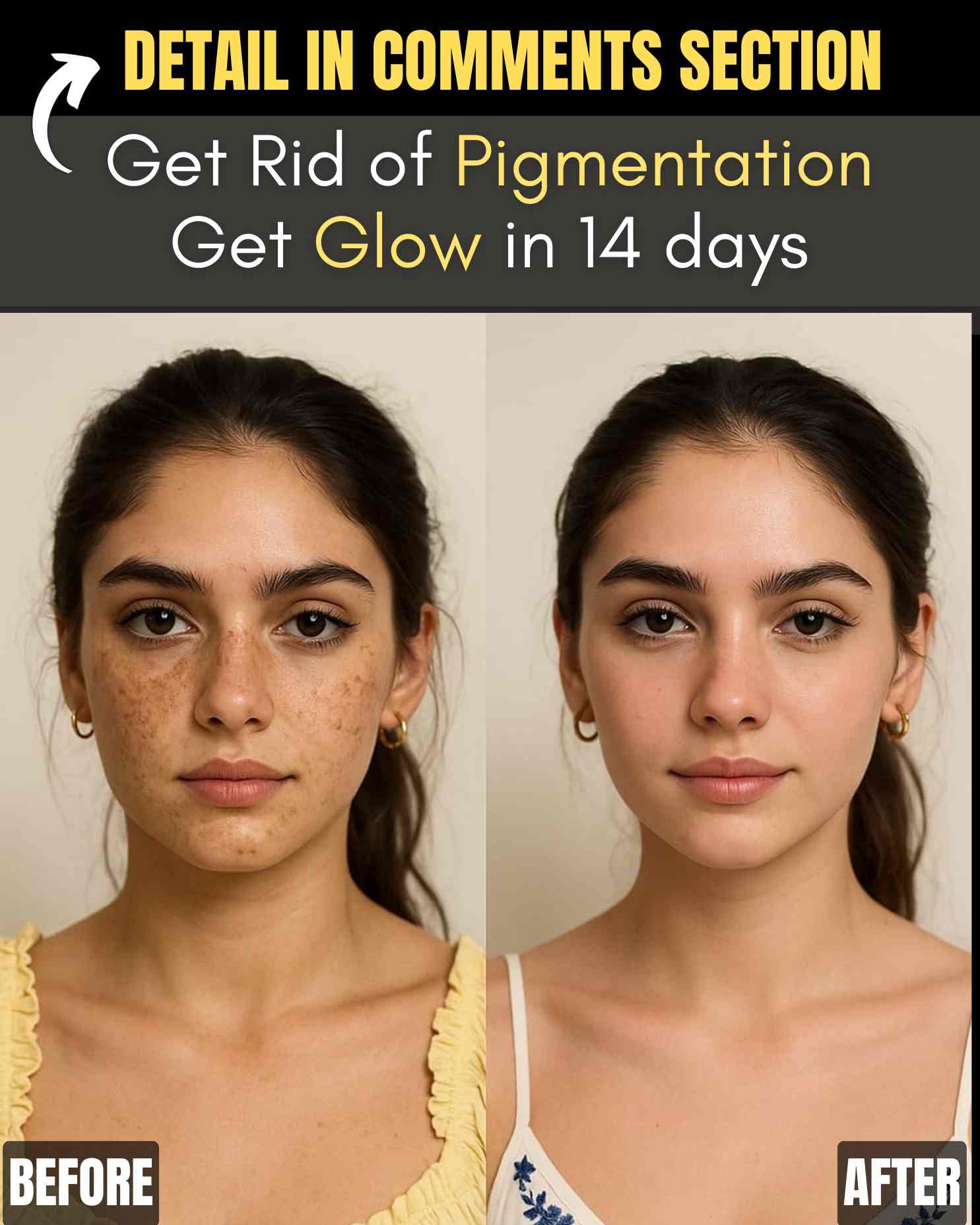 Get Rid of Pigmentation and Get Glow in 14 Days – Effective Home ...