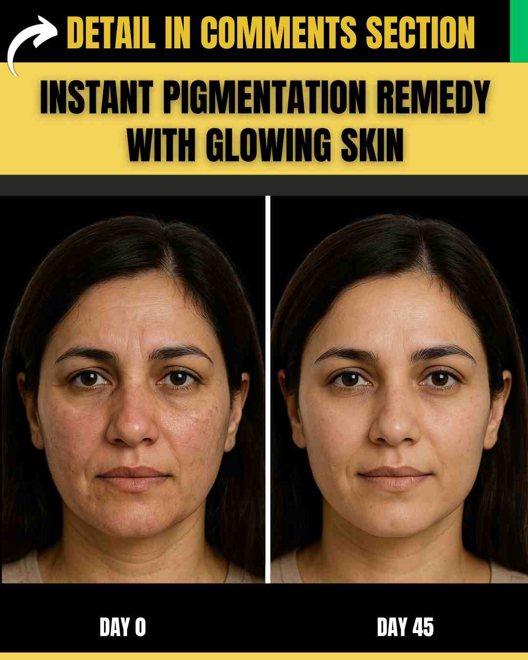 INSTANT PIGMENTATION REMEDY WITH GLOWING SKIN - V Beautify