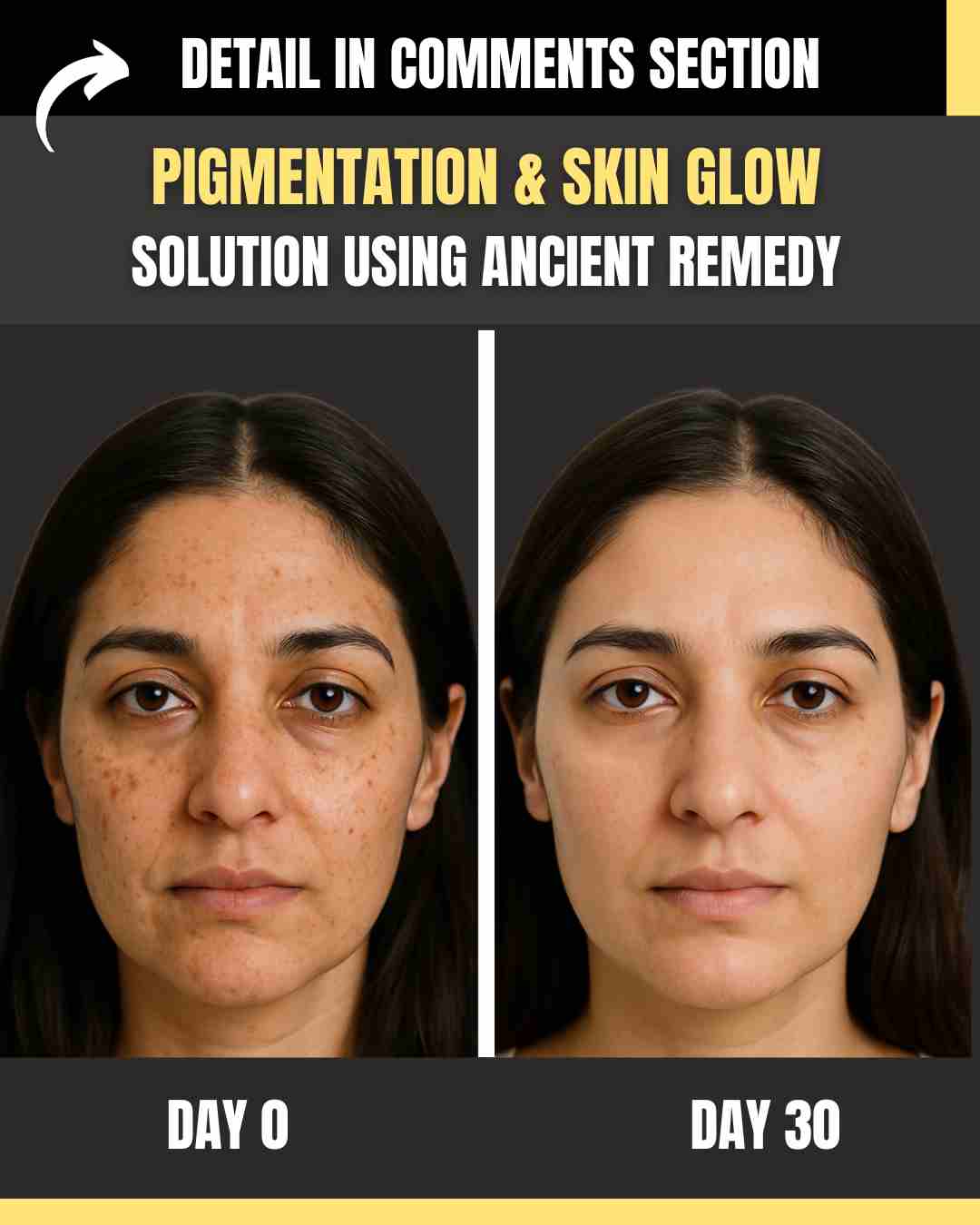 PIGMENTATION & SKIN GLOW SOLUTION USING ANCIENT REMEDY - V Beautify