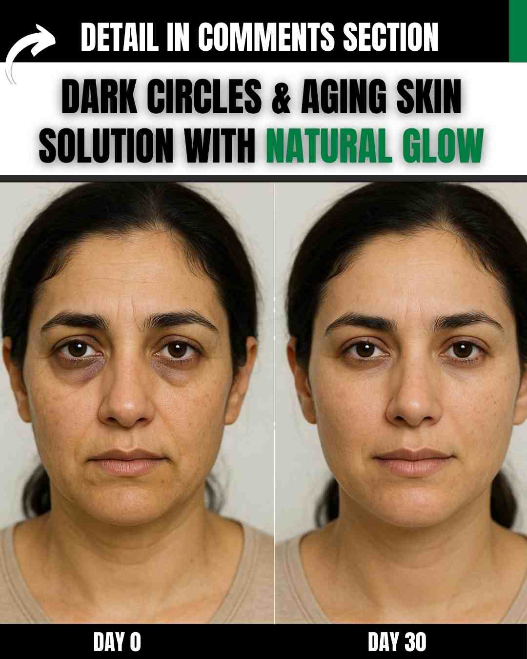 Dark Circles & Aging Skin Solution with Natural Glow - V Beautify
