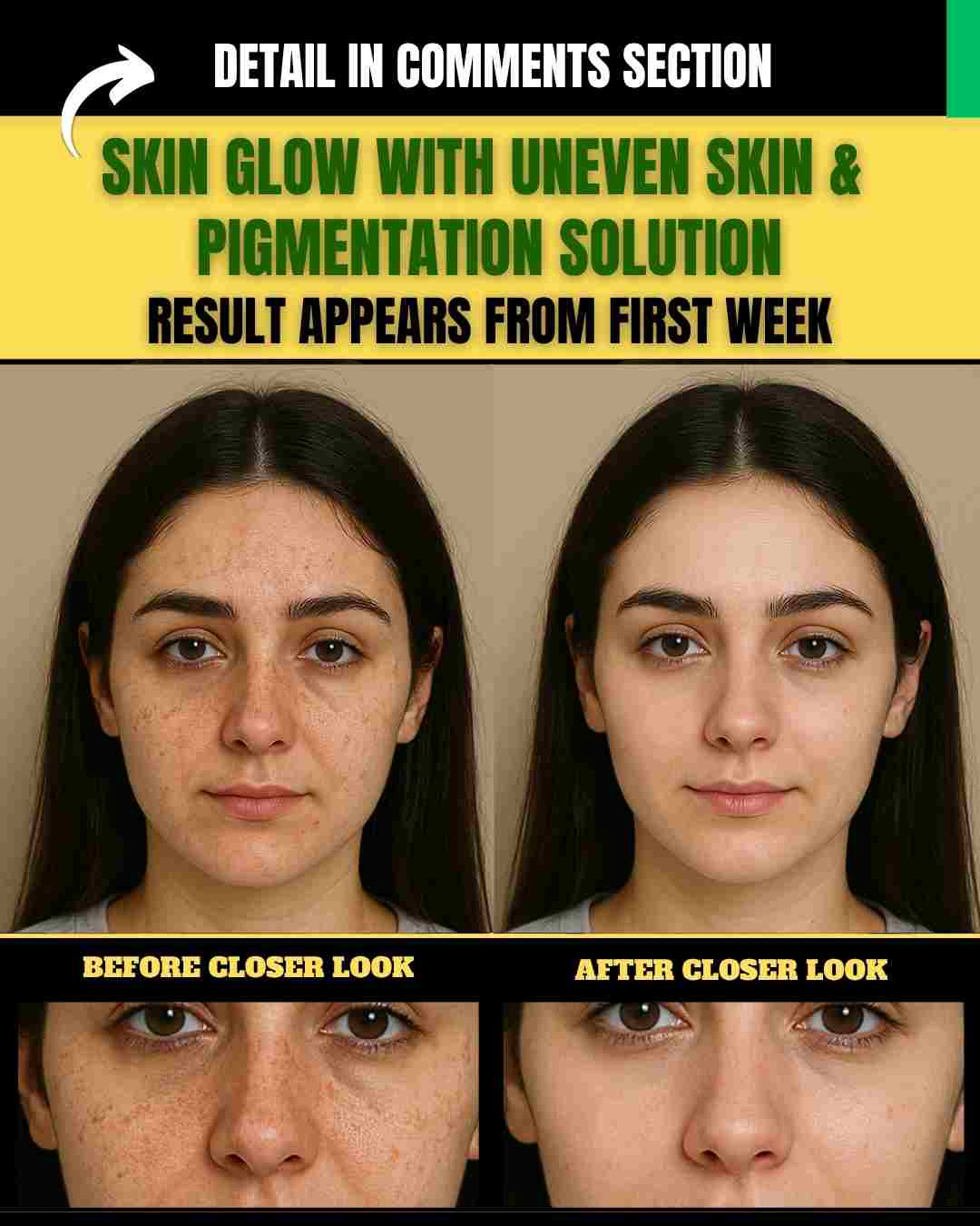 SKIN GLOW WITH UNEVEN SKIN AND PIGMENTATION SOLUTION - V Beautify