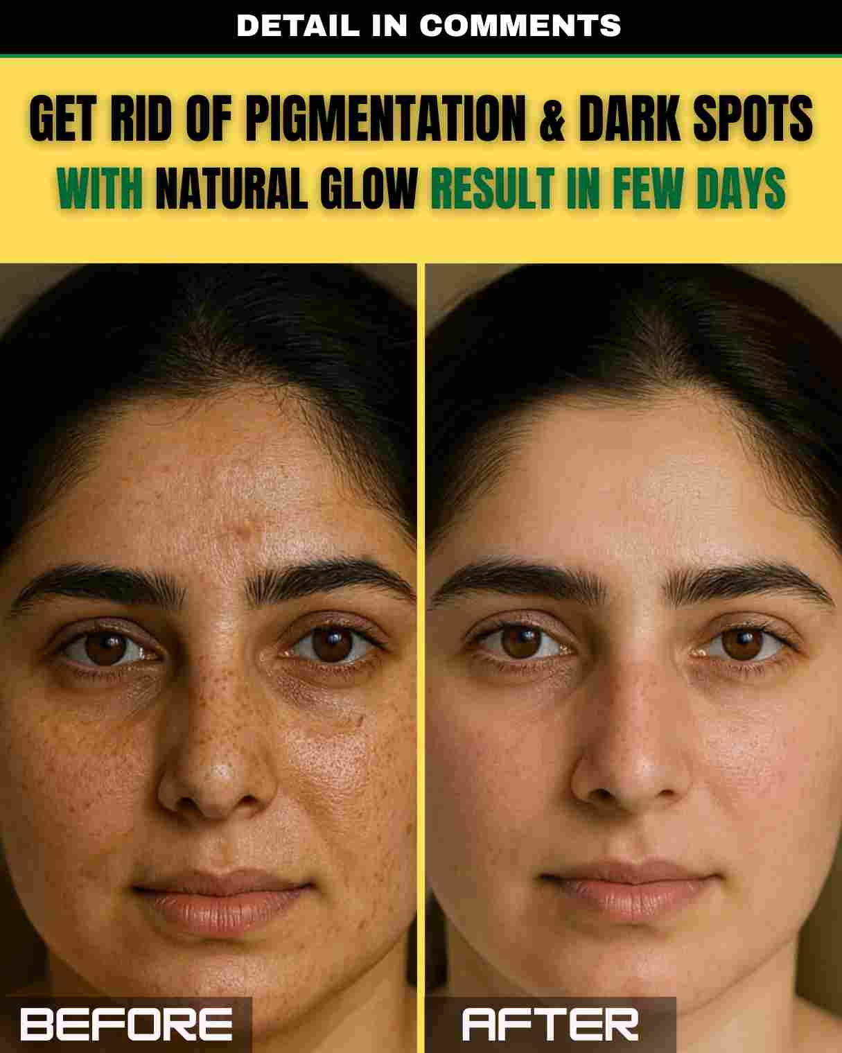 Get Rid of Pigmentation & Dark Spots with Natural Glow – Visible ...