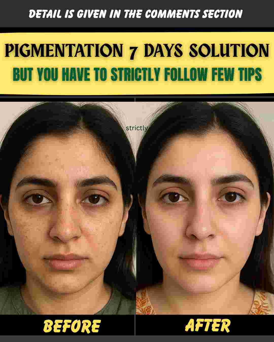 PIGMENTATION 7 DAYS SOLUTION – CLEAR, EVEN-TONED SKIN NATURALLY - V ...