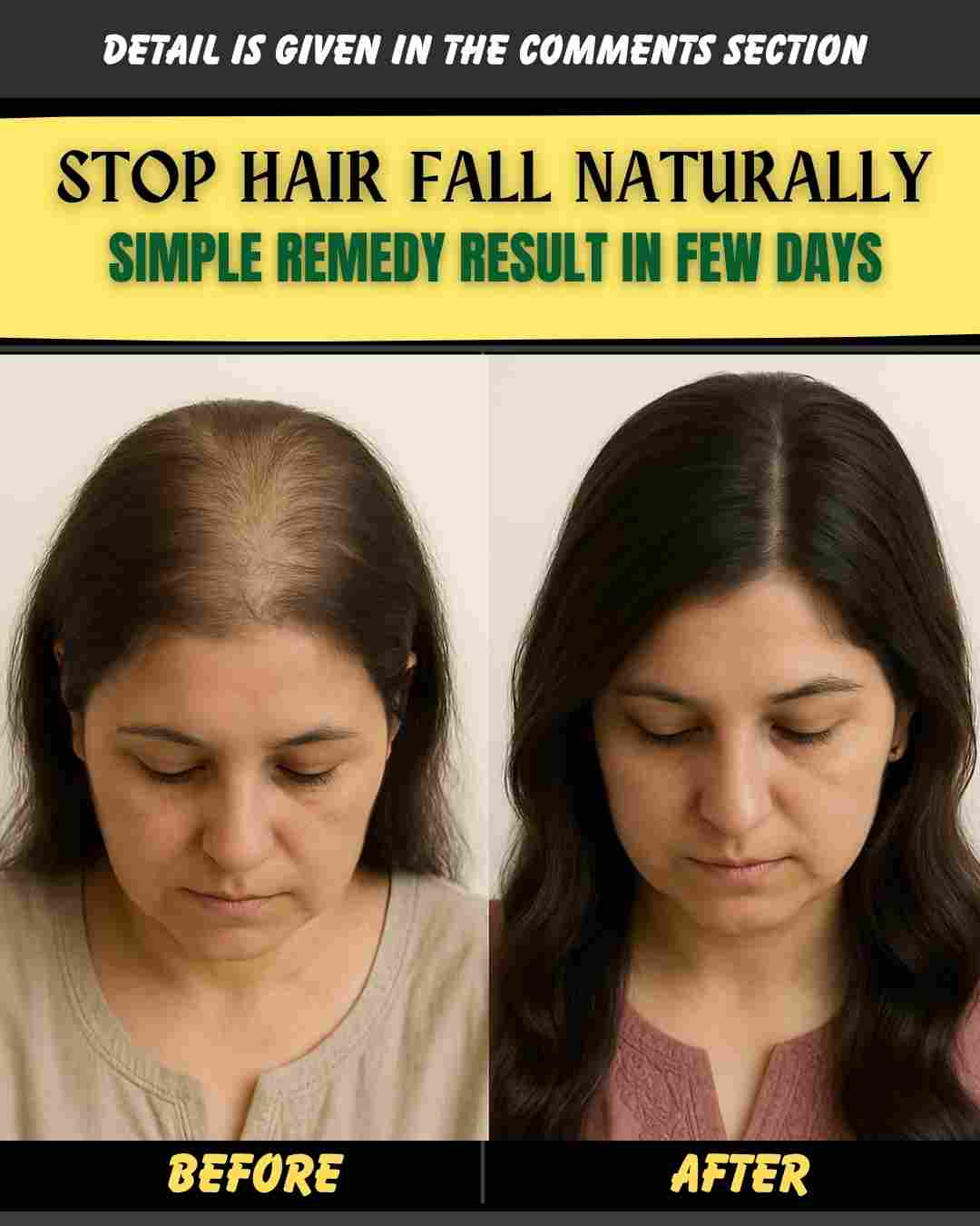 STOP HAIR FALL NATURALLY – SIMPLE REMEDY RESULT IN FEW DAYS - V Beautify