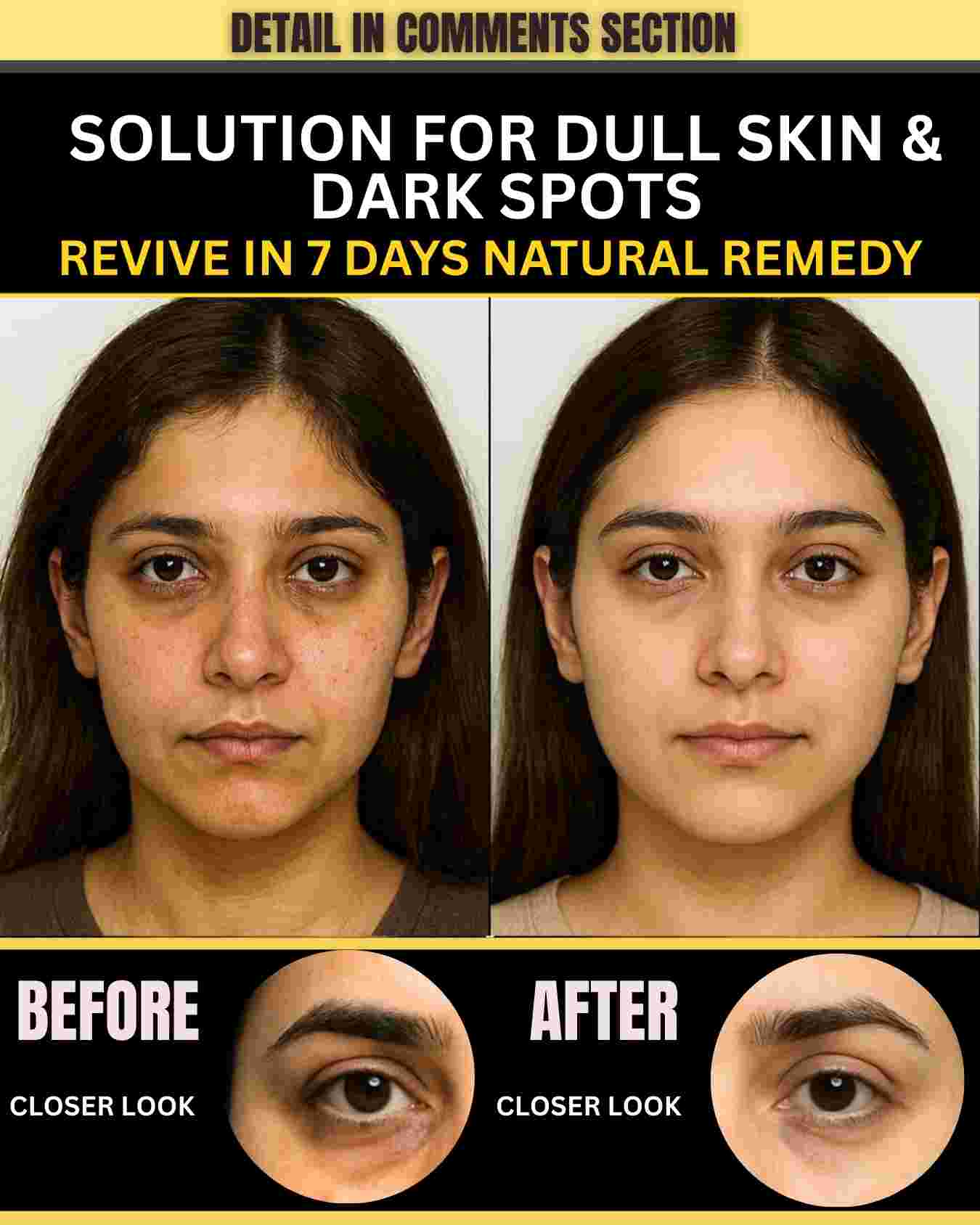 Solution for Dull Skin & Dark Spots – Revive in 7 Days (Natural Remedy ...