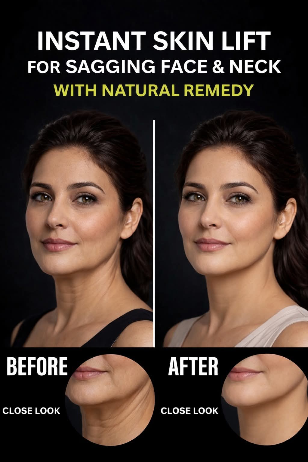 INSTANT SKIN LIFT FOR SAGGING FACE AND NECK - V Beautify