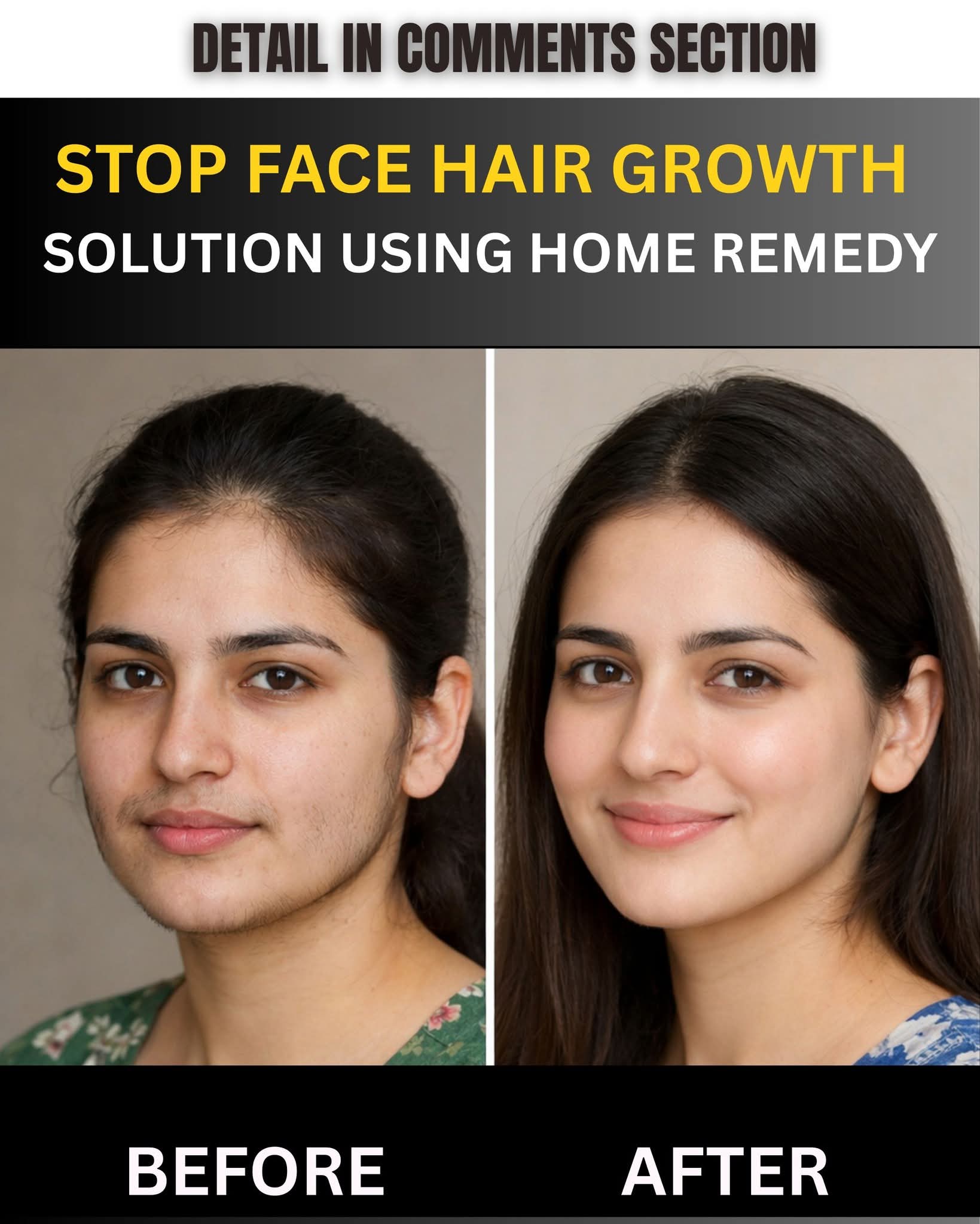 Stop Face Hair Growth Using Home Remedies (Safe & Natural Approach) - V ...