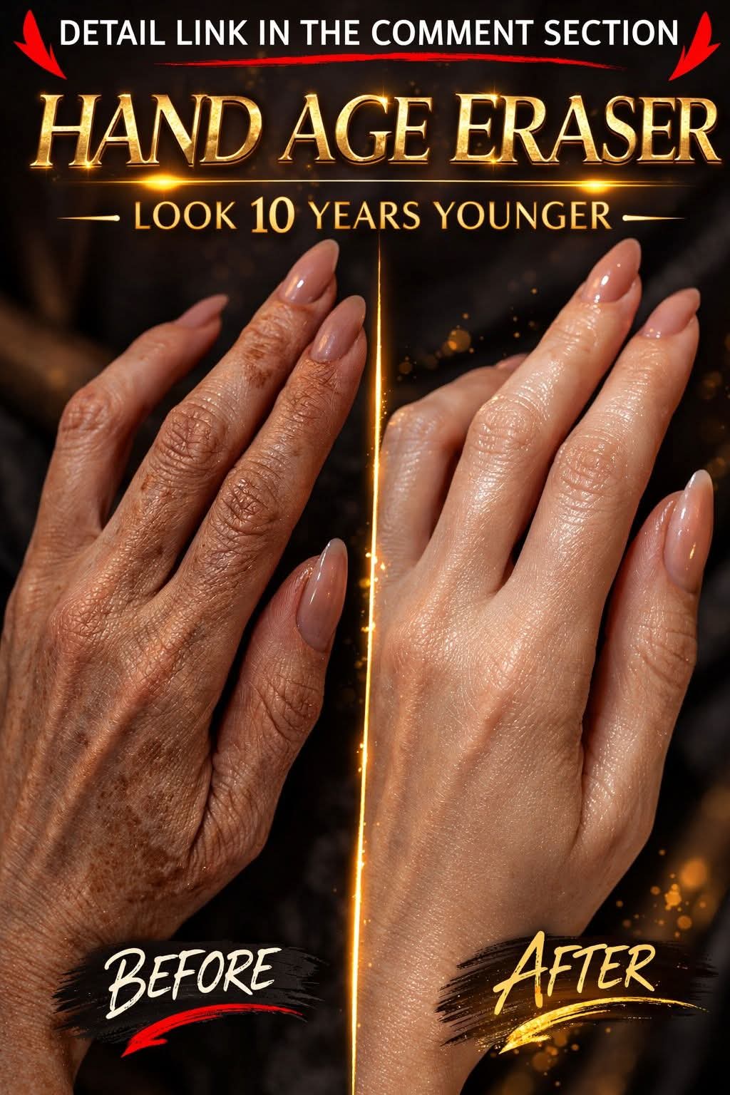Hand Age Eraser: Look 10 Years Younger Naturally at Home - V Beautify